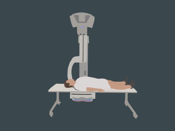 DX-D 300 U-arm - Agfa Radiology Solutions