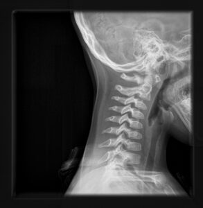 Homepage ES - Agfa Radiology Solutions
